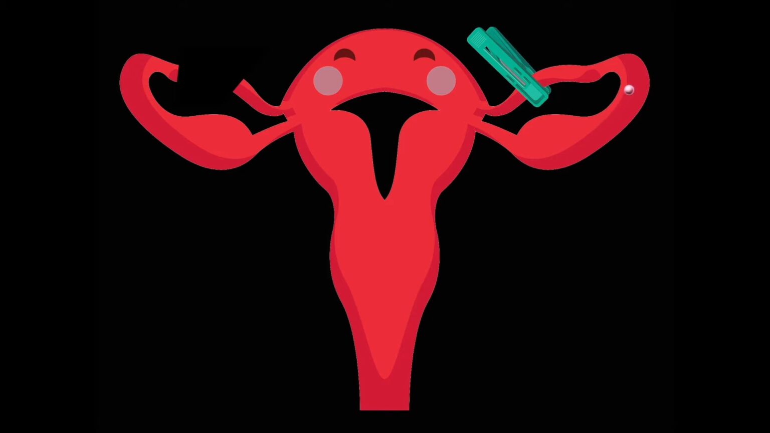 Tubal Reversal Surgery